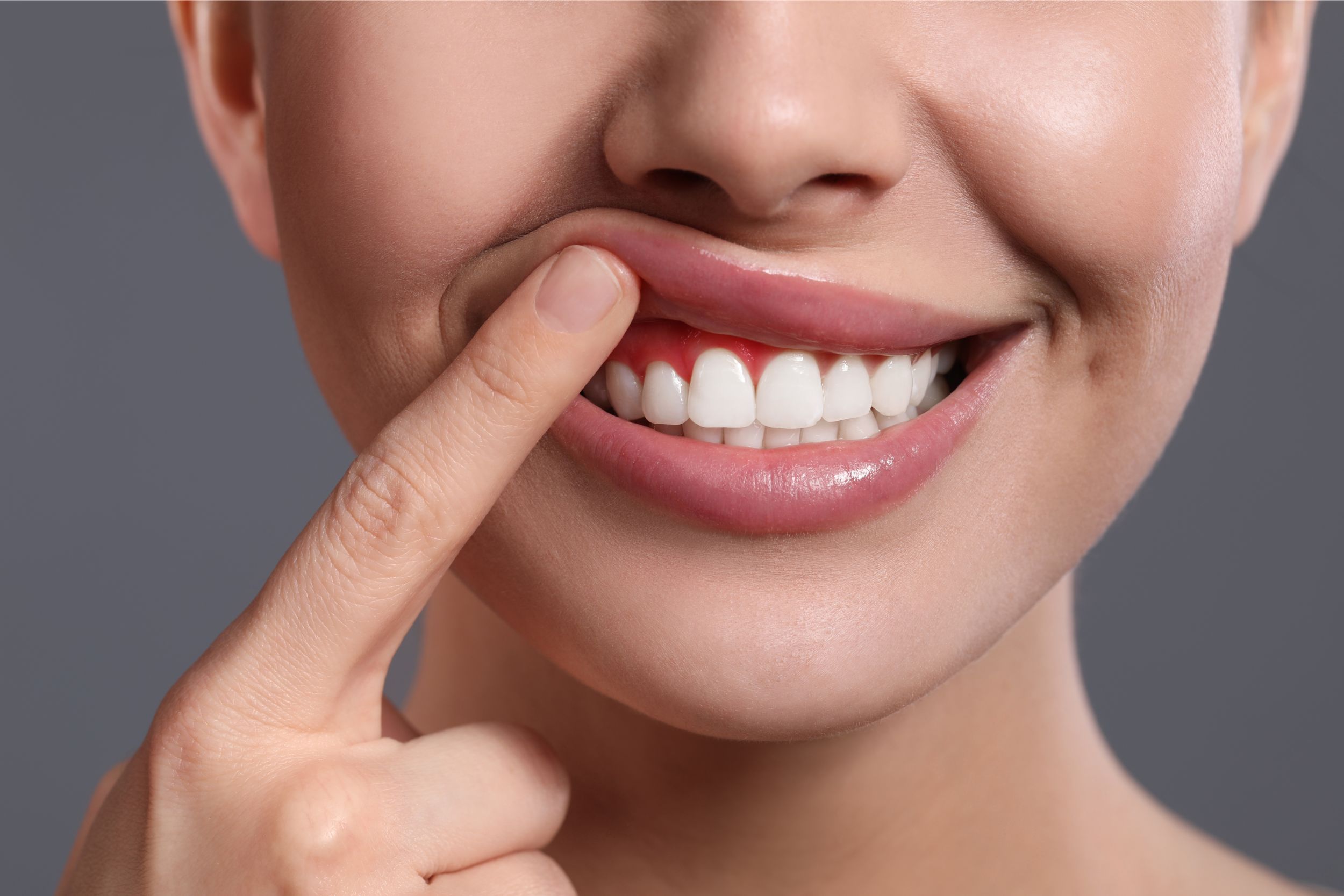 Receding Gums - Gentle Dentistry of San Diego